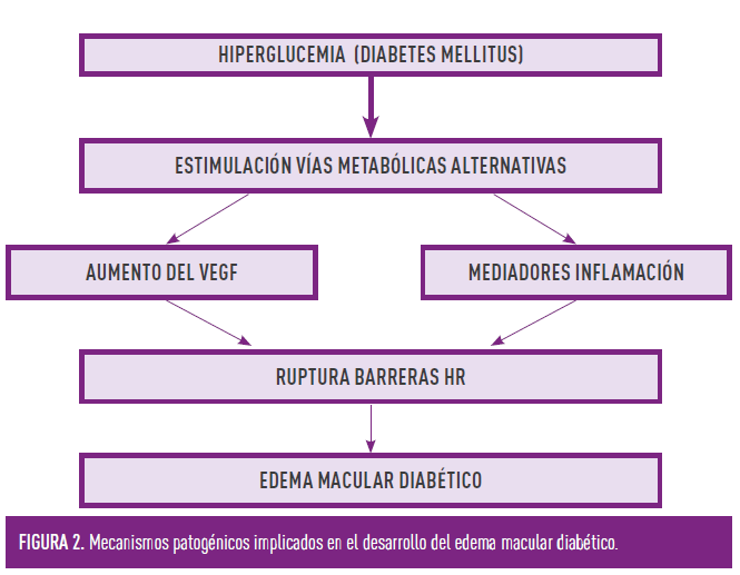 Fisiopatologia Do Edema Macular Diabetico Diabetic Macular Edema